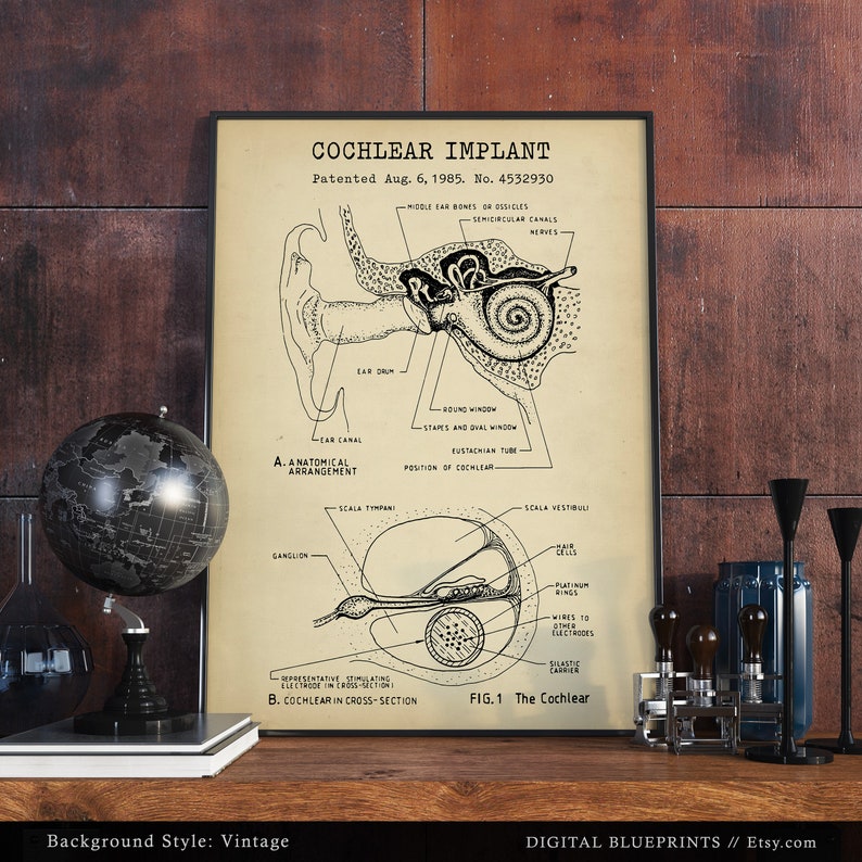Cochlear Implant Patent Print, Anatomy Wall Art, Audiologist Gift ...
