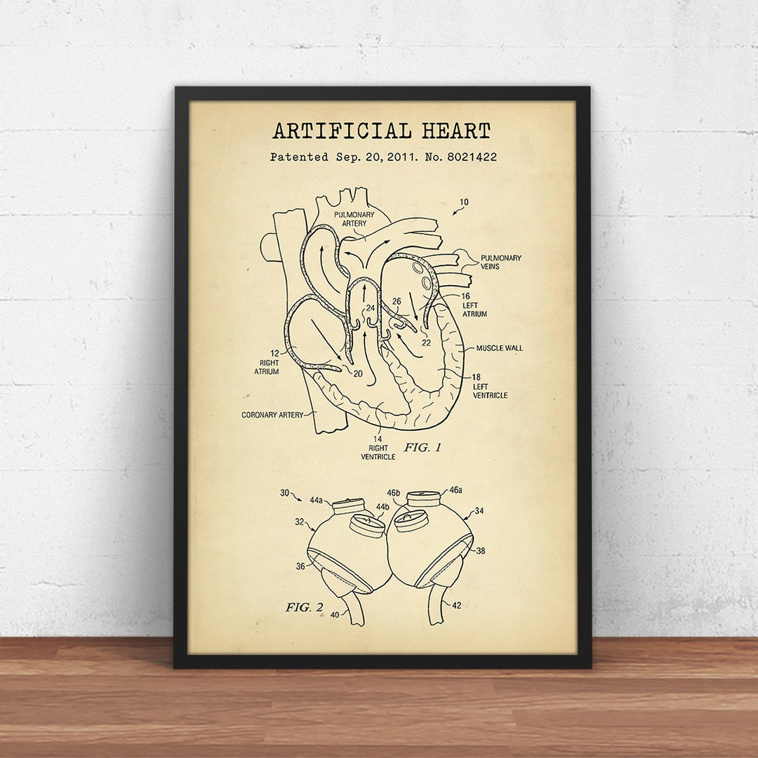 Artificial Heart Patent Print, Gift for Surgeon, Cardiologist Gifts ...