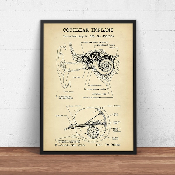 Cochlear Implant Wall Art - Etsy