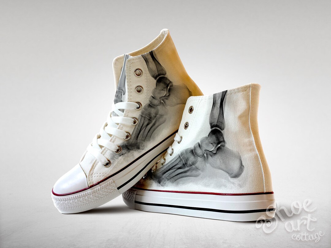 X-ray, Feet Bones, Ankle, Custom Made Shoes - Etsy