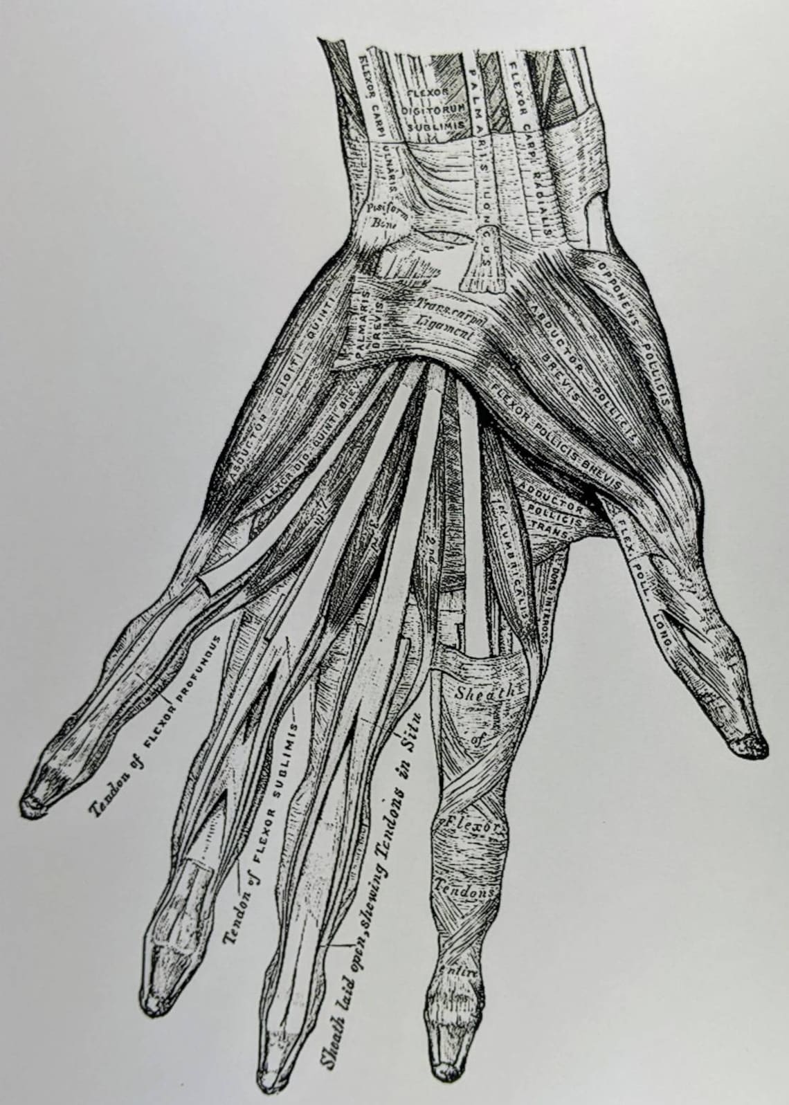 Hand Muscles Anatomy Print | Etsy