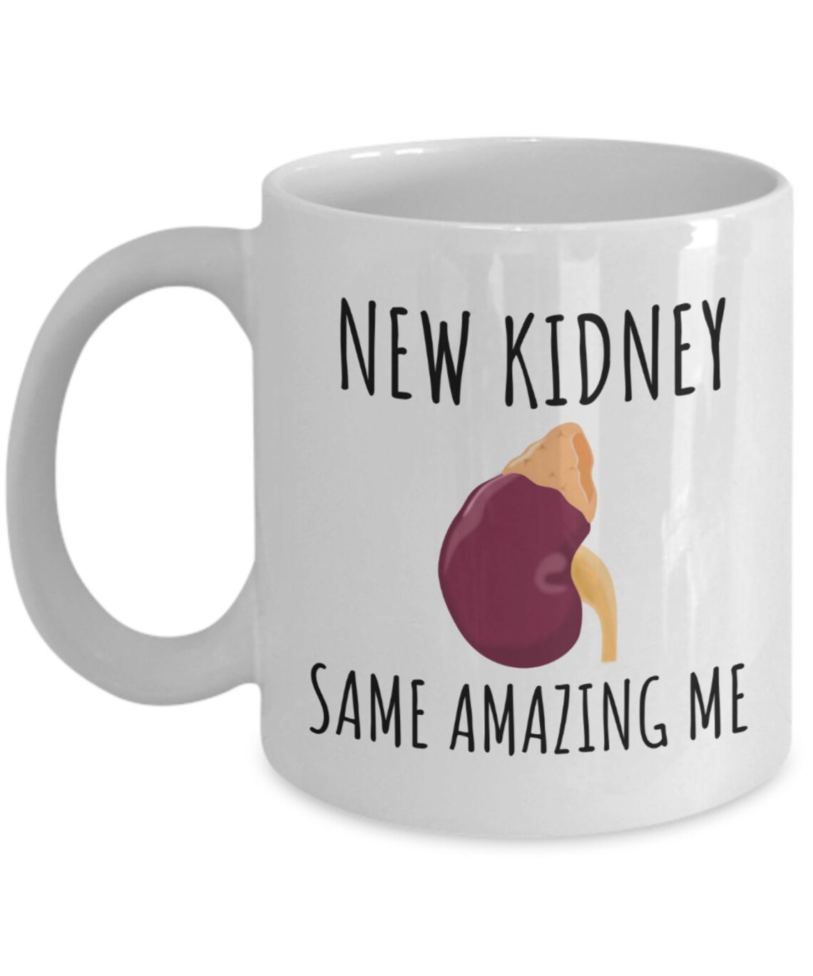 Kidney Recipient Mug - Kidney Transplant Gift - Kidney Surgery Present ...
