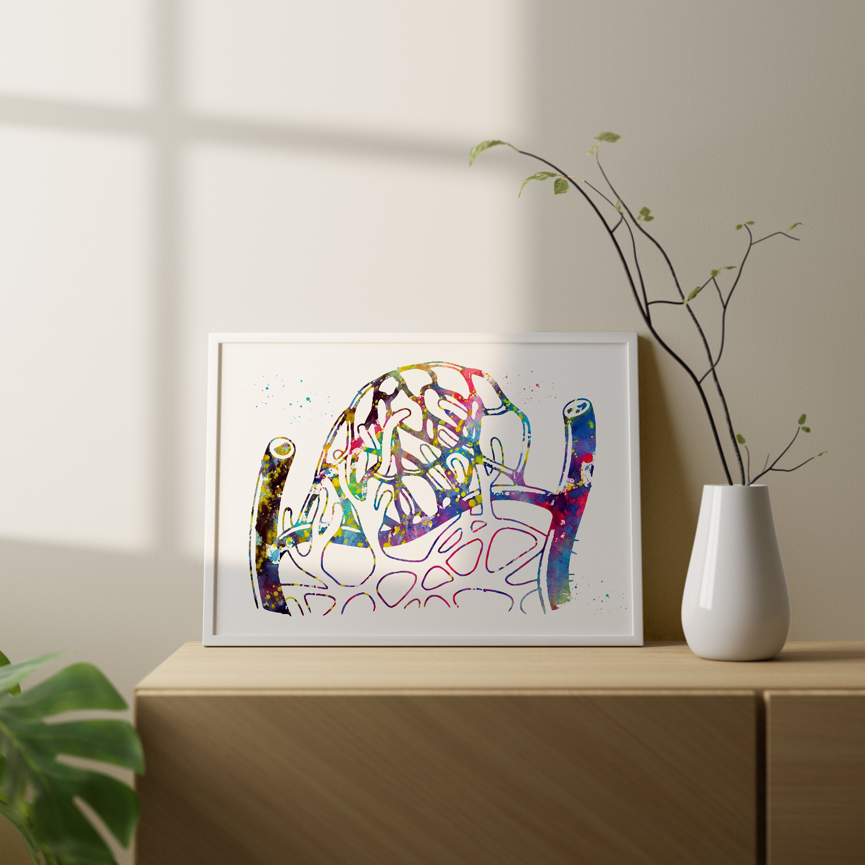 Lymphatic Capillaries in the Tissue Spaces Lymph Poster | Etsy