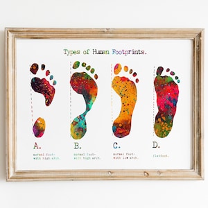 Types of Footprints Orthopedics Art Podiatry Decor Biology Poster ...