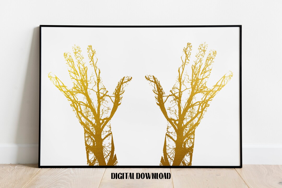 Human Blood Vessels Hand Medical Art Anatomical Art Orthopedic Hand ...