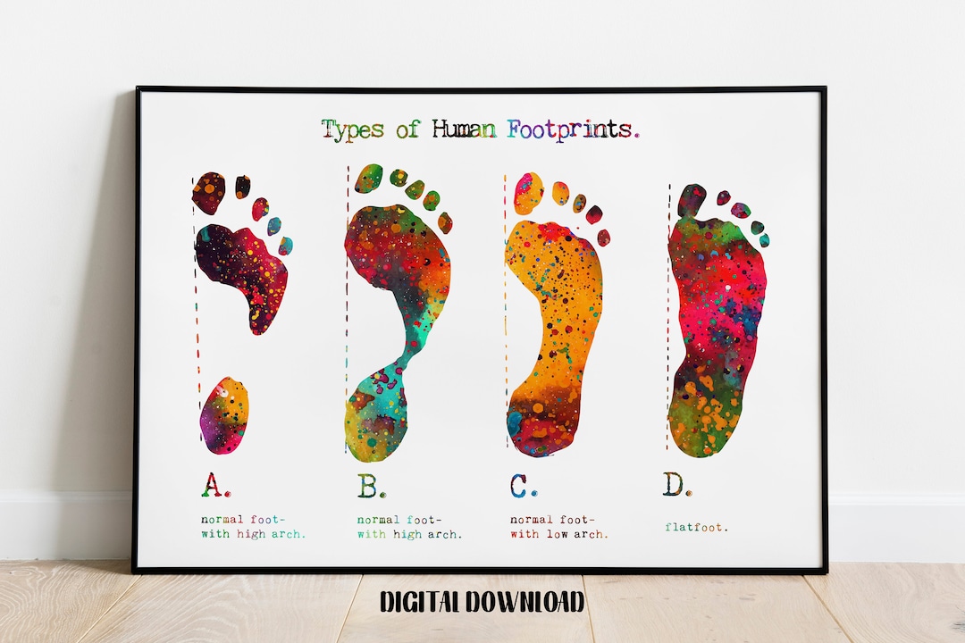 Types of Footprints Orthopedics Art Podiatry Decor Biology Poster ...