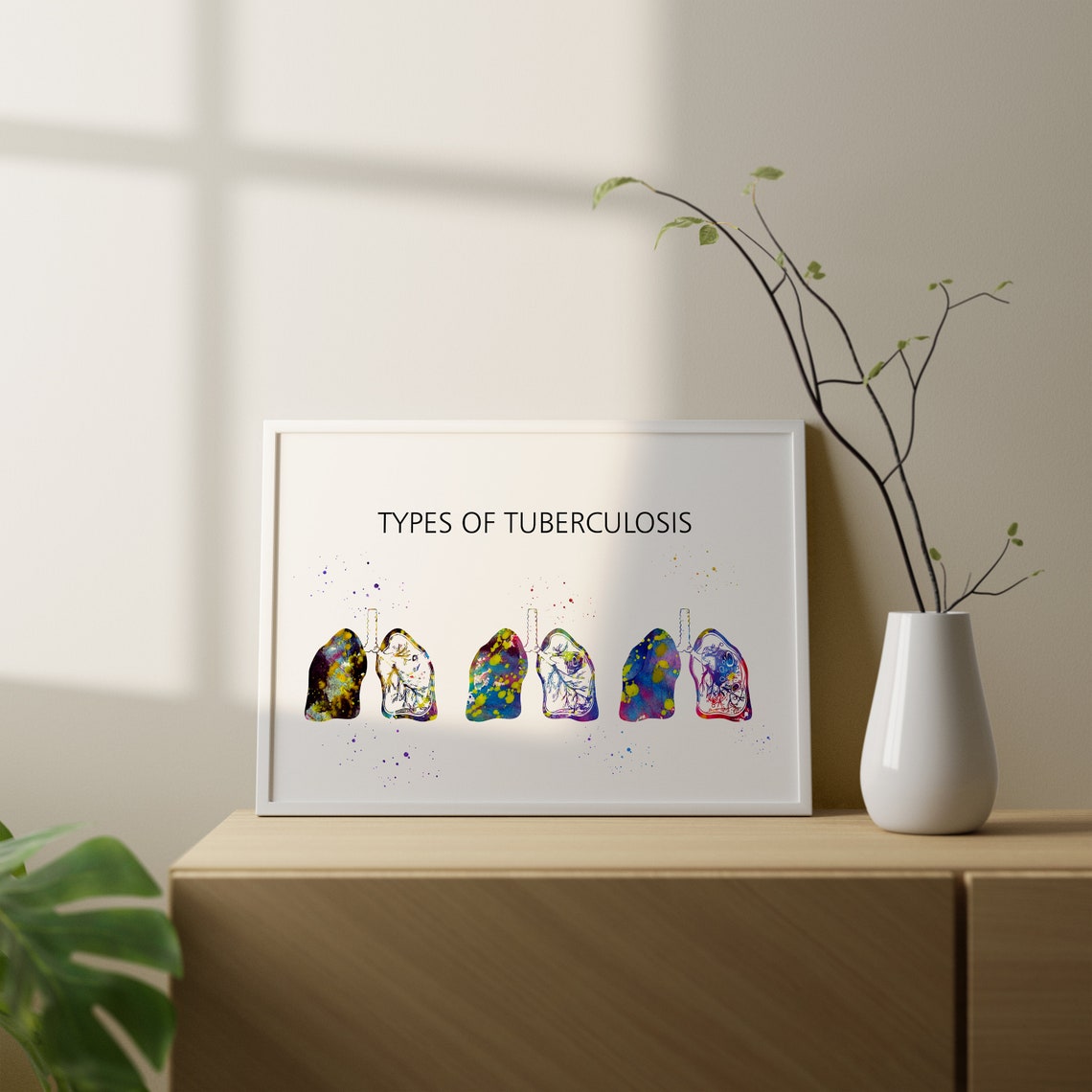 Tuberculosis Types Lung Anatomy Poster Medical Science - Etsy