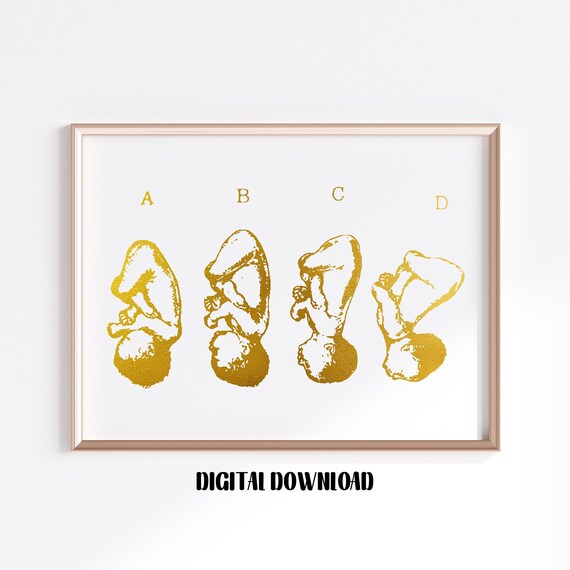 Posición cefálica embarazo feto feto desarrollo bebé posición - Etsy España