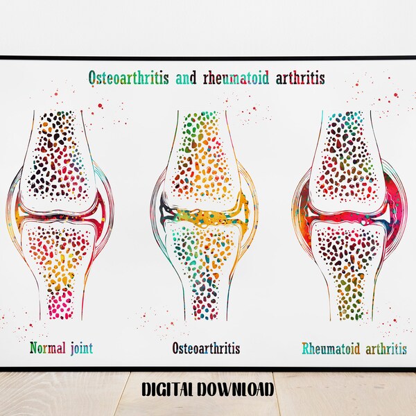 Rheumatology Poster - Etsy