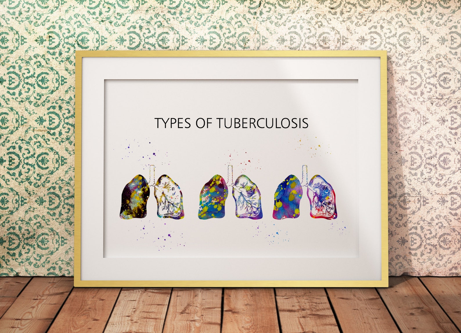 Tuberculosis Types Lung Anatomy Poster Medical Science - Etsy
