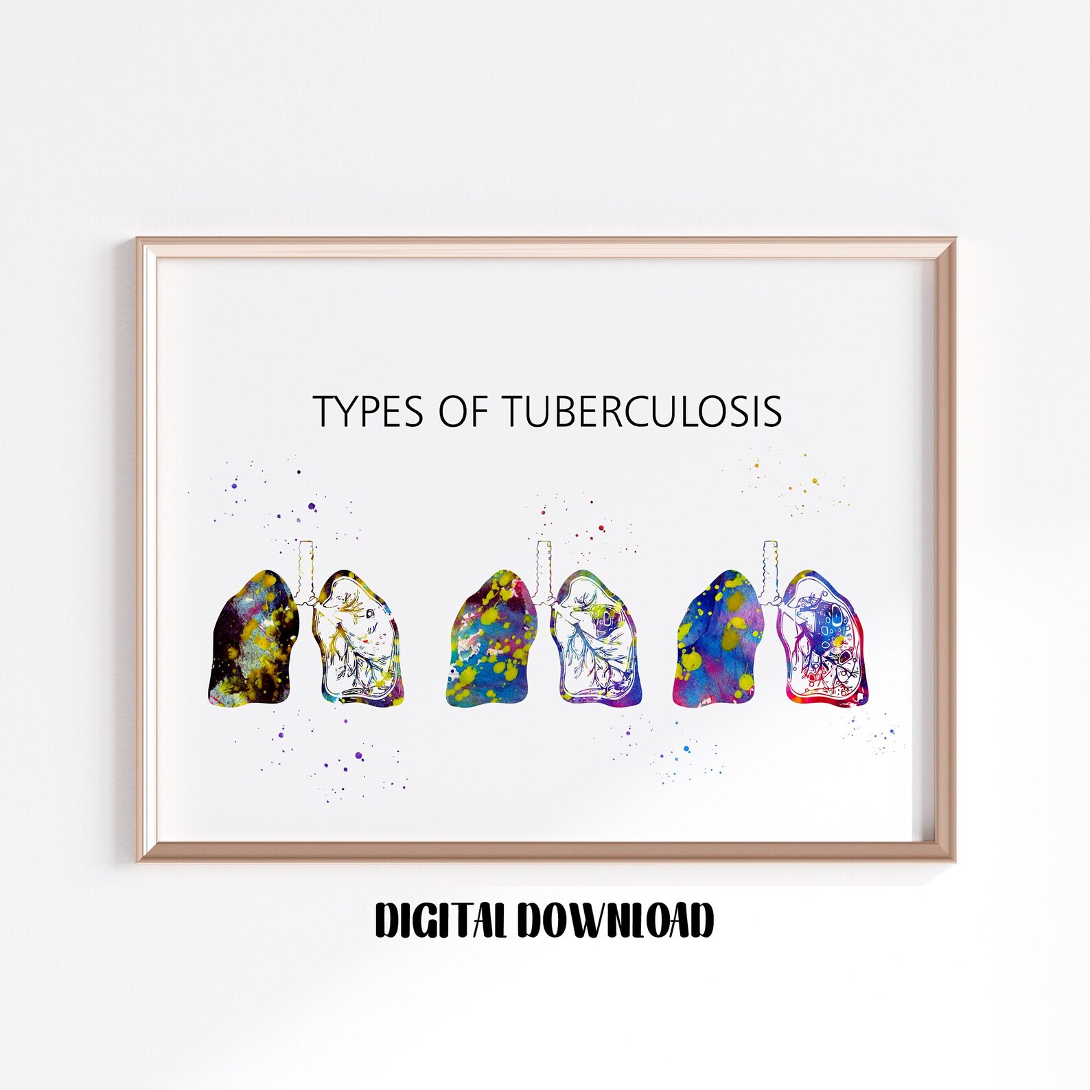 Tuberculosis Types Lung Anatomy Poster Medical Science - Etsy
