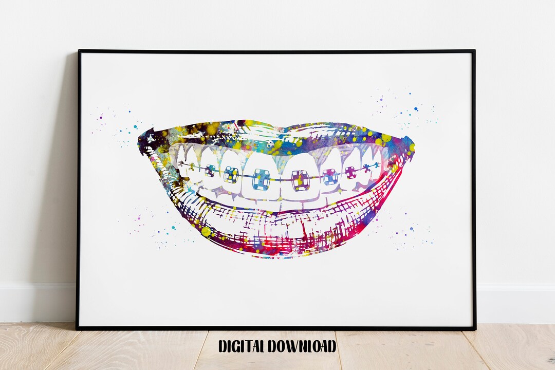Watercolor Teeth Braces Print: Dental Anatomy Art (digital Download) - Etsy
