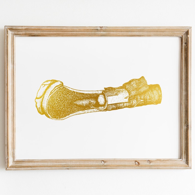 Bone Anatomy Structure Poster Orthopedic Surgeon Gift Medical - Etsy