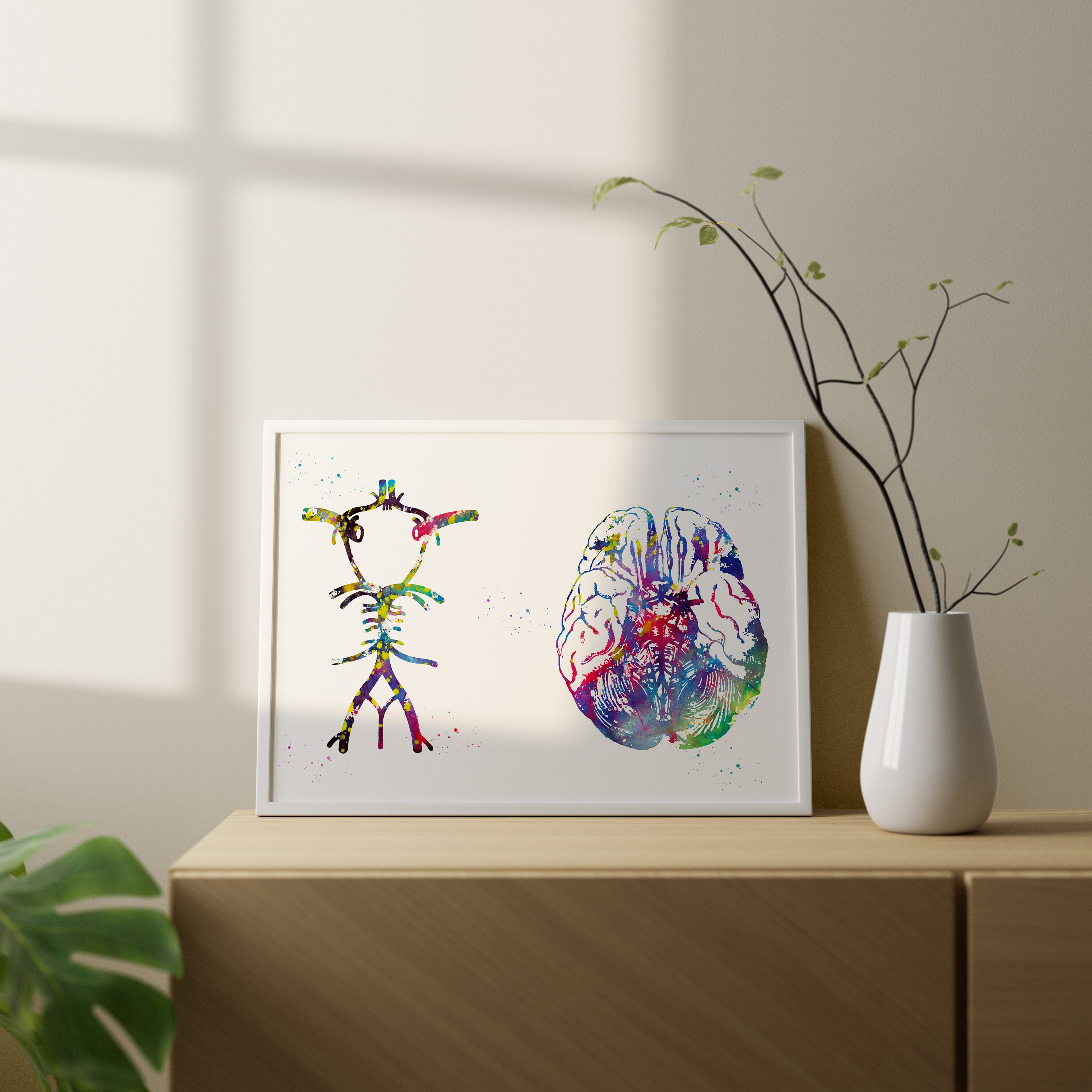 Circle of Willis Brain Anatomy Poster Medical Science | Etsy Canada