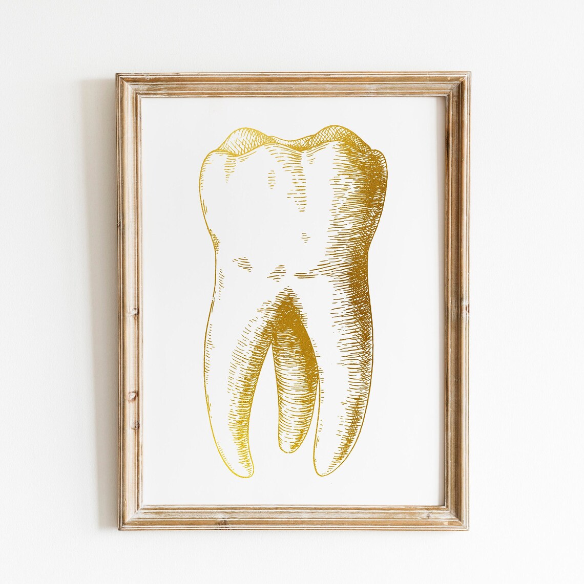 Human Tooth Anatomy Art Medical Dental Illustration Golden Art | Etsy