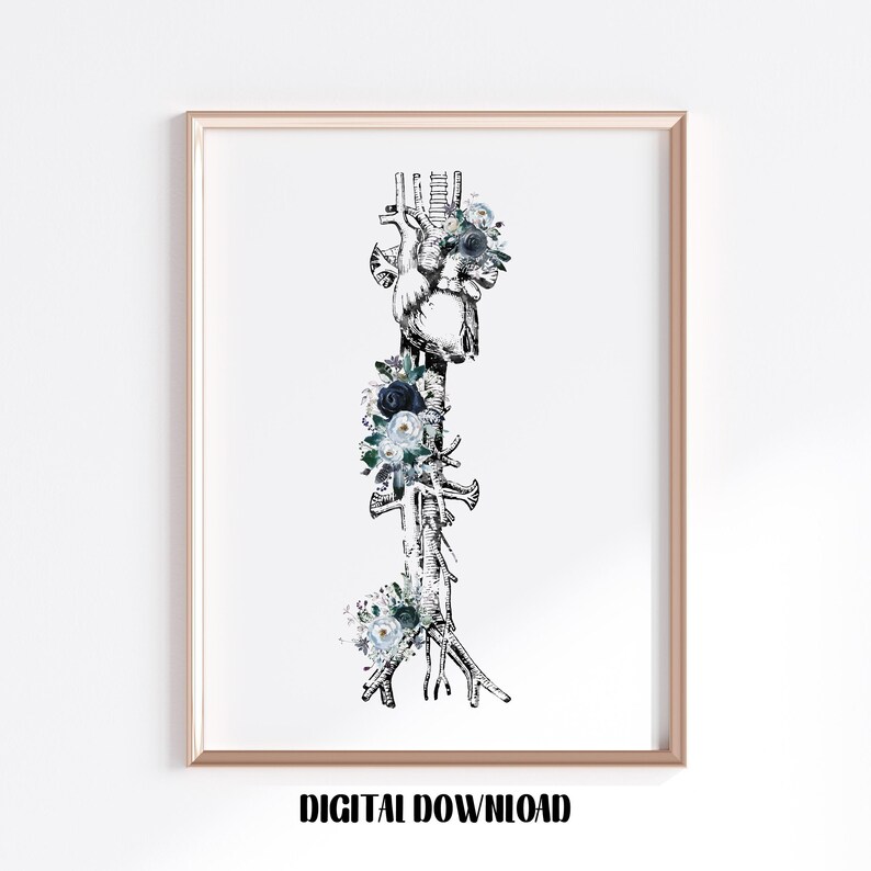 Aorta Vein and Heart Poster Anatomy Surgery Medical Science - Etsy