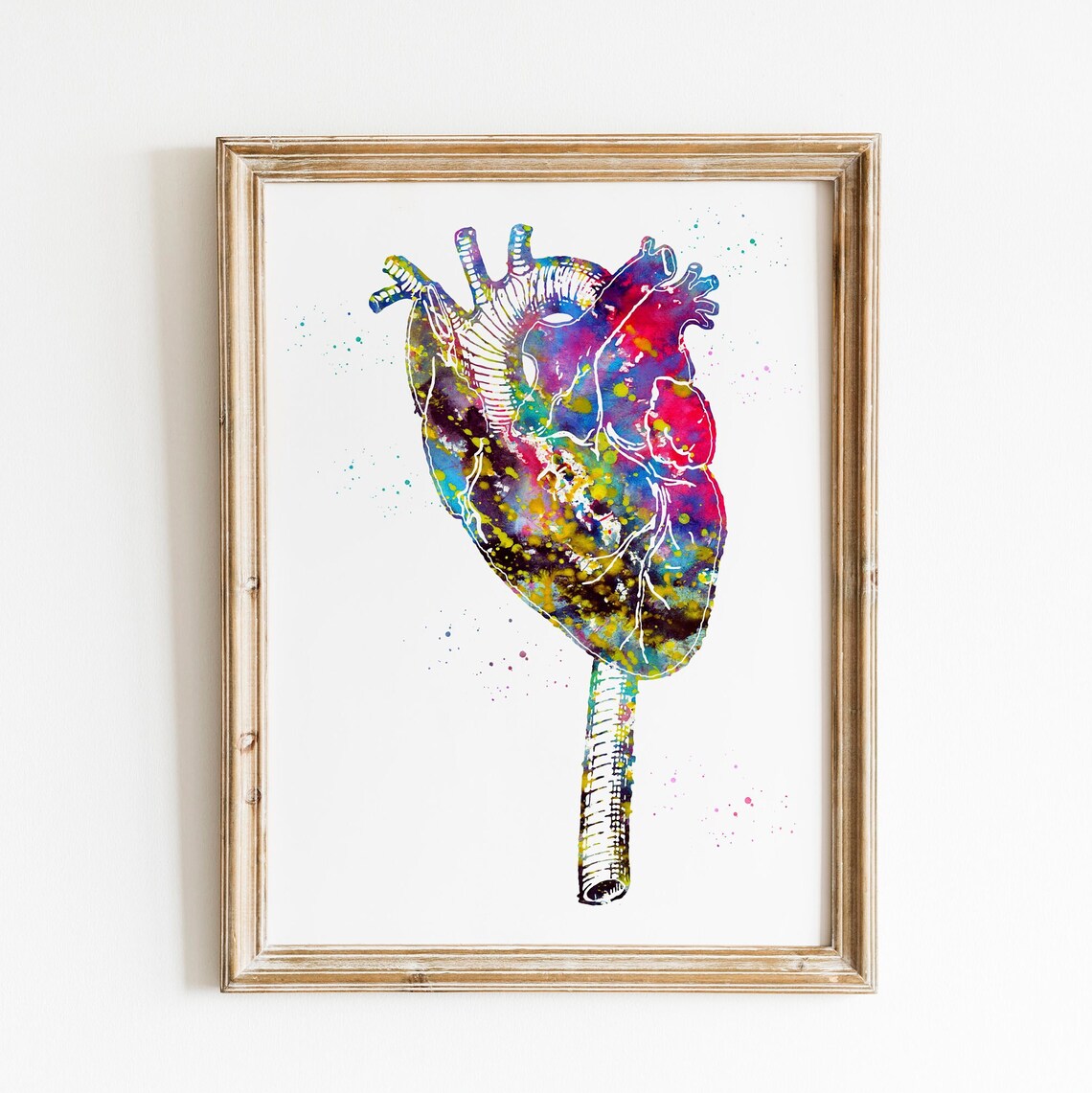 Aorta and Heart Anatomy Surgery Anatomical Biology Poster | Etsy