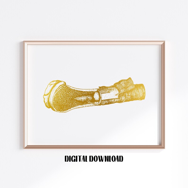 Bone Anatomy Structure Poster Orthopedic Surgeon Gift Medical - Etsy