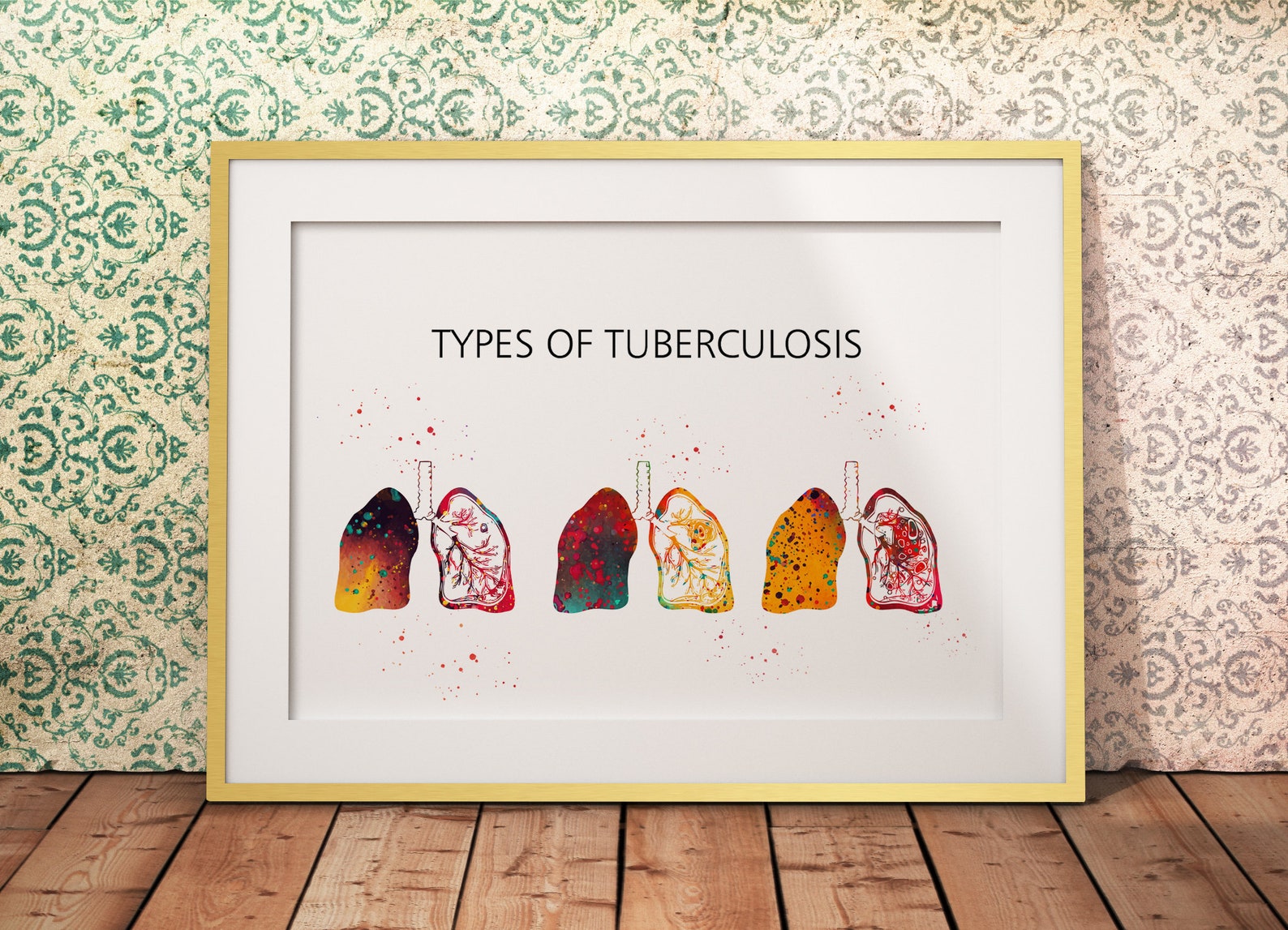 Tuberculosis Types Lung Anatomy Poster Medical Science - Etsy