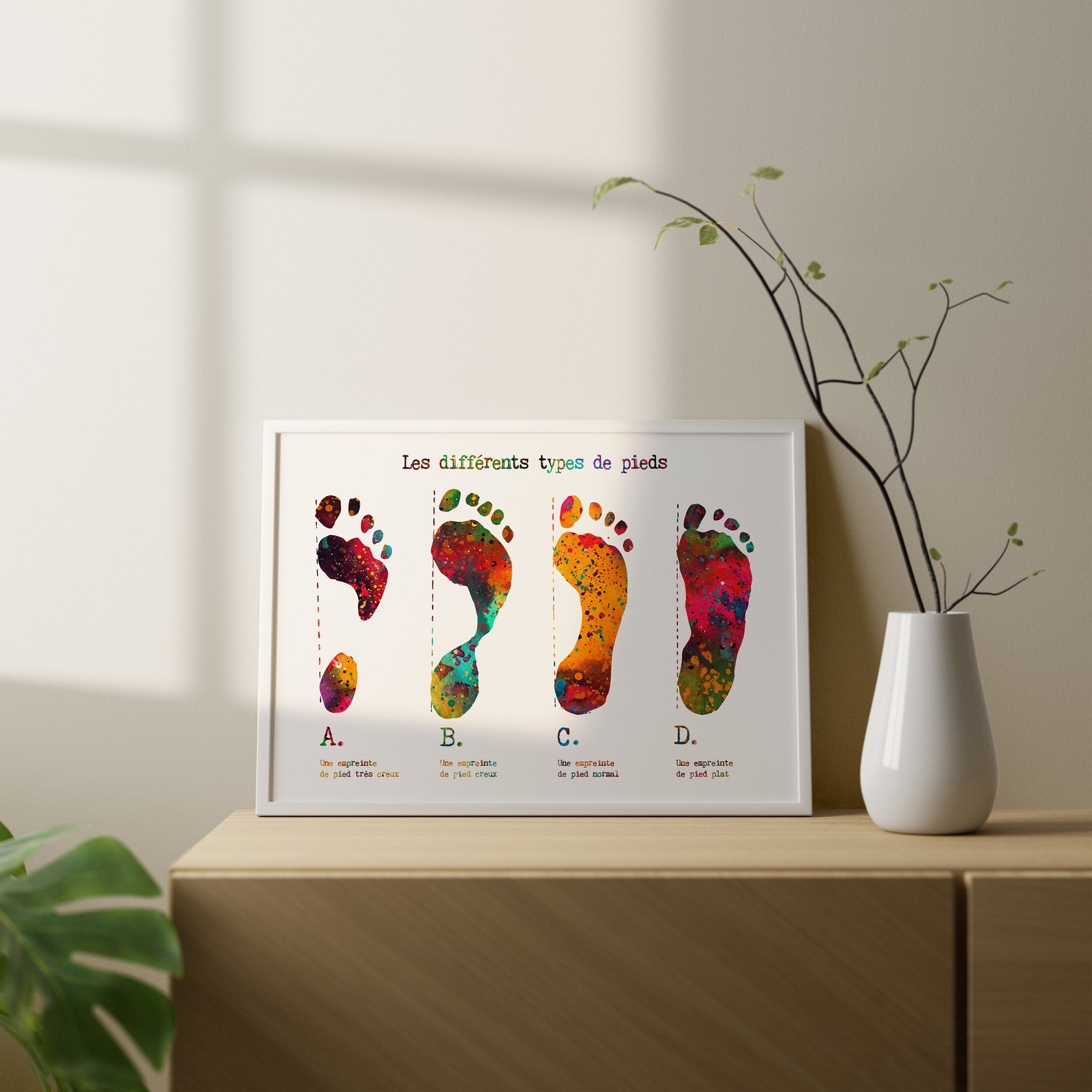 Types of Footprints With French Text Orthopedics Art Podiatry - Etsy