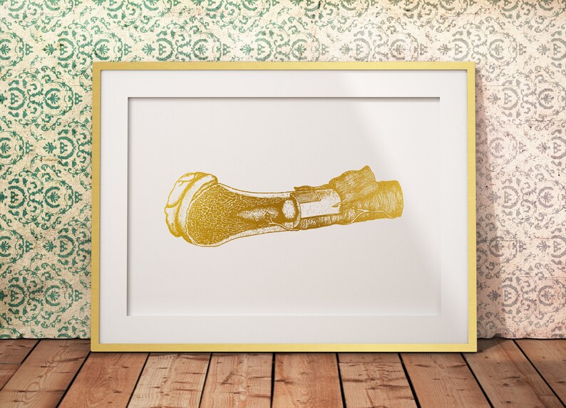 Bone Anatomy Structure Poster Orthopedic Surgeon Gift Medical - Etsy