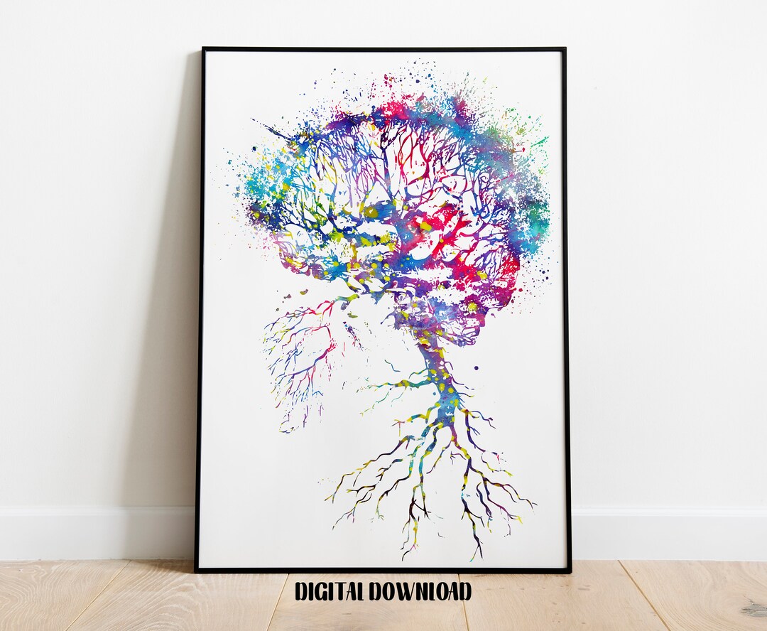 Epilepsy Brain Anatomy Neurological Disorder Neurology Biology Poster ...