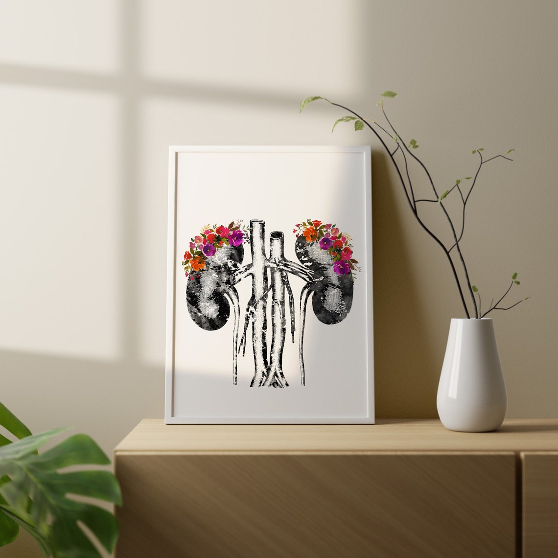 Kidneys Anatomy Human Kidneys Poster Urology Art Kidney - Etsy