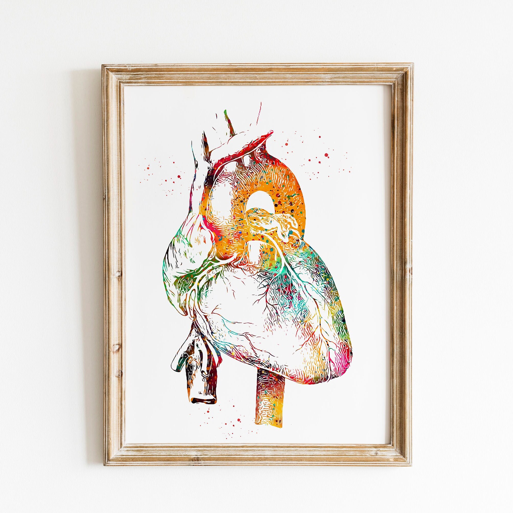 Human Heart Anatomy Surgery Poster Medical Science Watercolor - Etsy