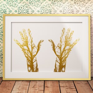 Human Blood Vessels Hand Medical Art Anatomical Art Orthopedic Hand ...