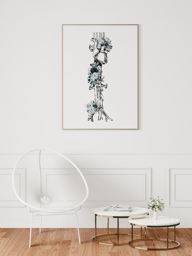 Aorta Vein and Heart Poster Anatomy Surgery Medical Science - Etsy