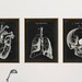 Anatomy Print SET of 3, Anatomical Poster on Black, Skull Print, Heart ...