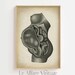 Pregnancy Anatomy Print, Fetus Vintage Anatomy Poster, Pregnant Medical ...