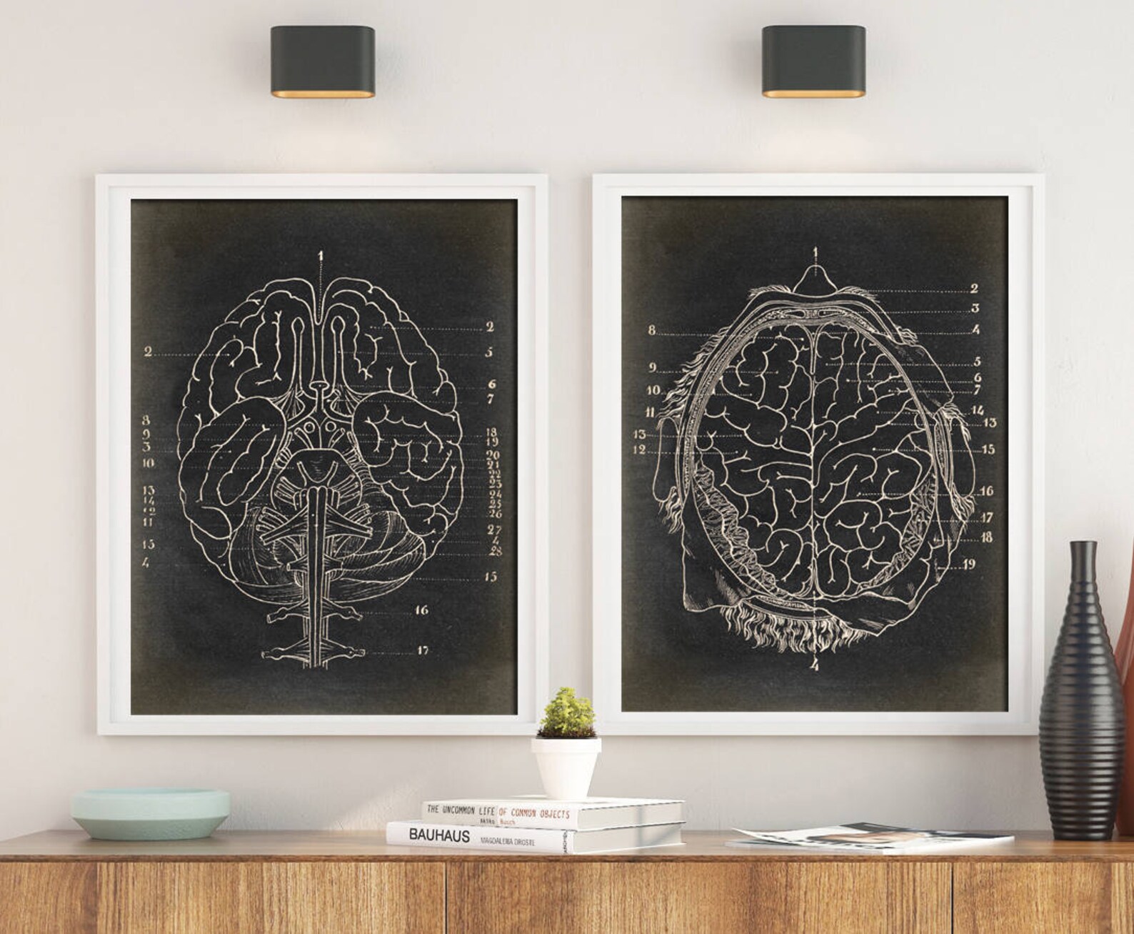 ANATOMY PRINT Set of 2 Anatomical Chart of the Brain Brain - Etsy