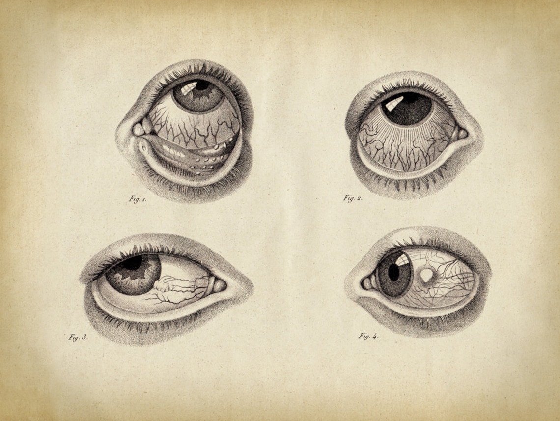 Eyes Anatomy Print Vintage Anatomy Poster Medical Wall Art - Etsy
