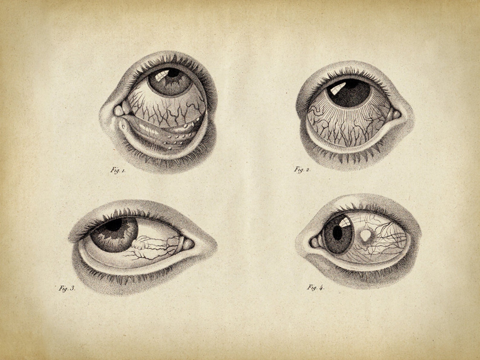 Eyes Anatomy Print Vintage Anatomy Poster Medical Wall Art - Etsy