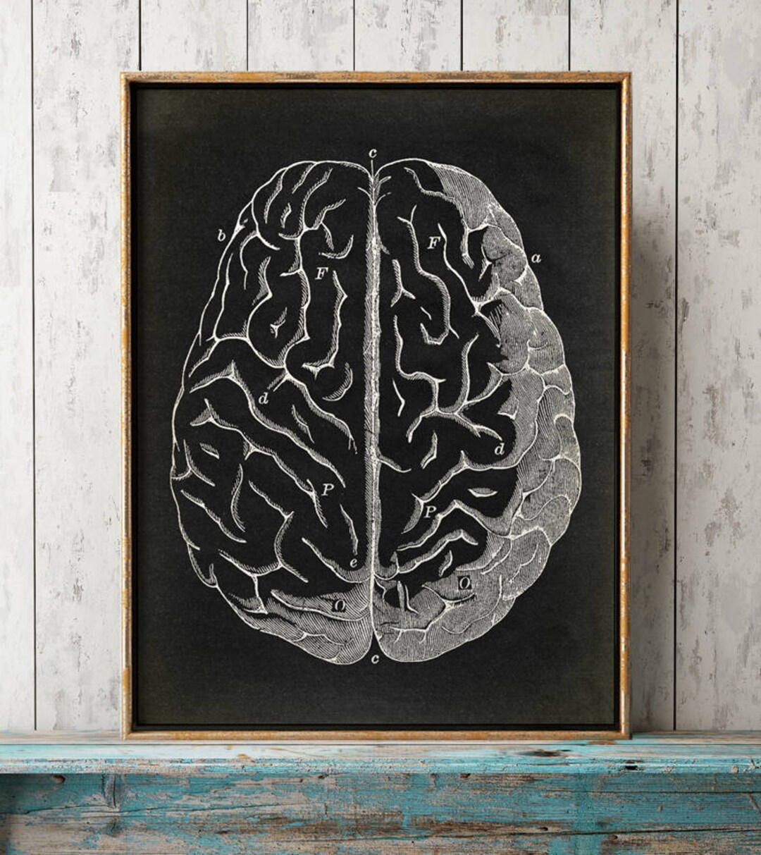 Anatomy Brain Print, Brain Poster, Anatomical Drawing, Aged Anatomy ...