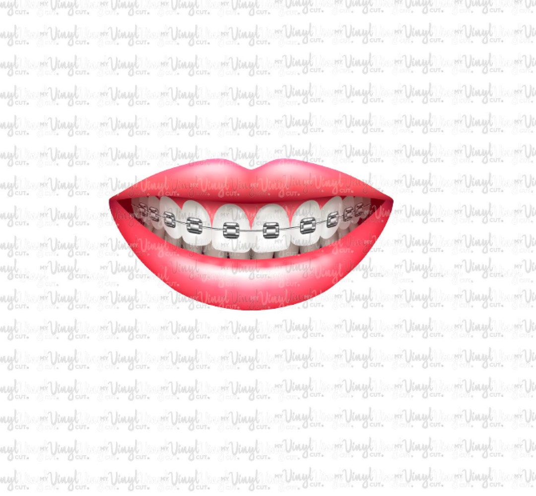 Mini Sticker I13 Smile With Braces PRINTED Vinyl Sticker 2 - Etsy