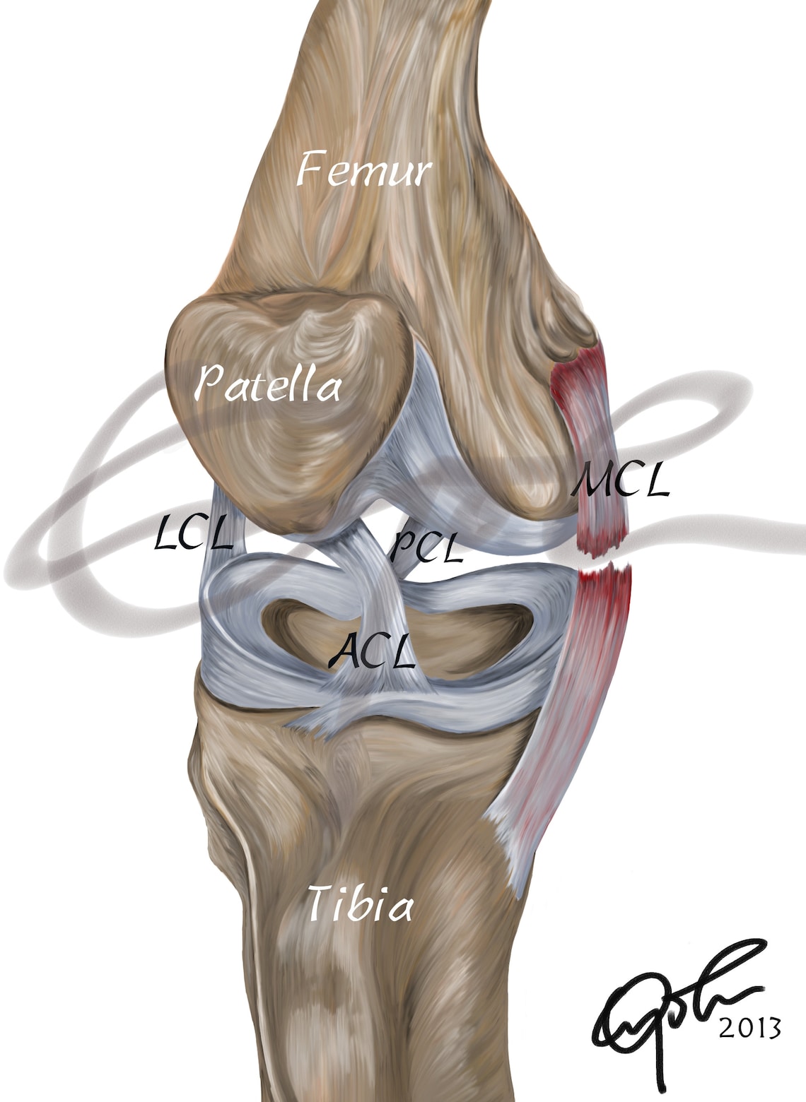Torn MCL Printable Download, Digital Illustration, Medical Drawing ...