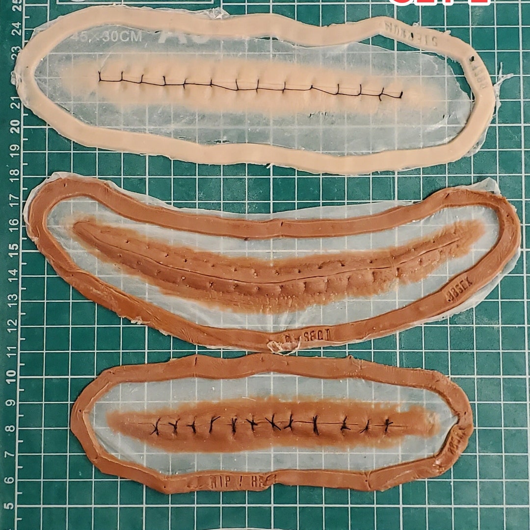 80% DISCOUNTED Prosthetics Bundles Encapsulated Silicone Piece ...