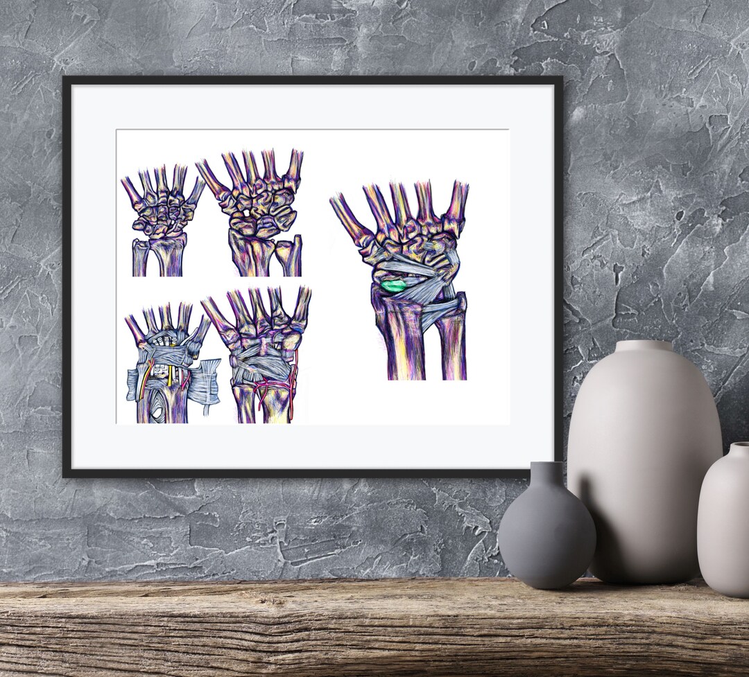 Bones and Ligaments of Wrist Front/back vibrant Colors Digital Hand ...