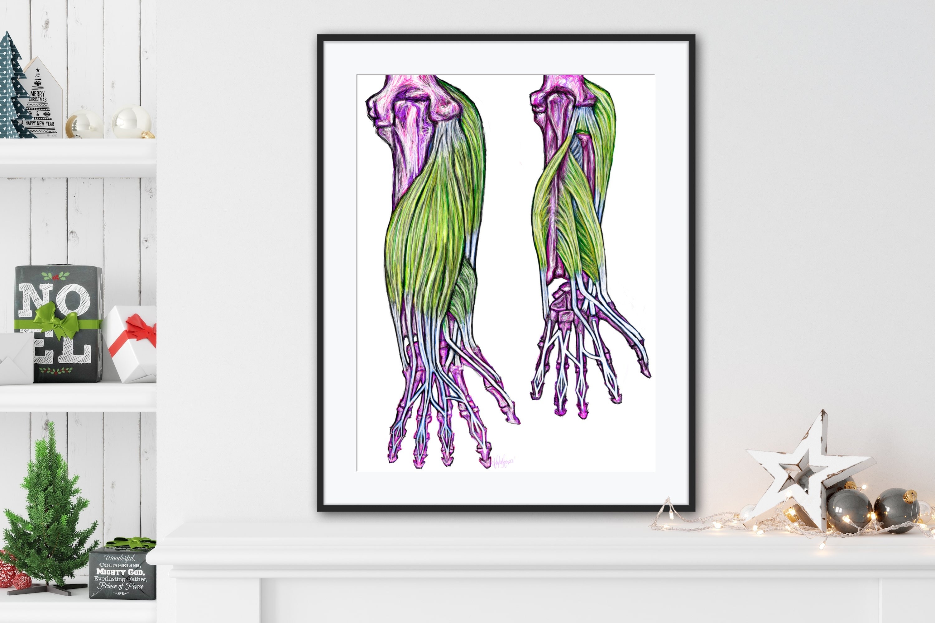 Indiv. Muscles of Forearm, Wrist Digits vibrant Colors,digital Hand ...
