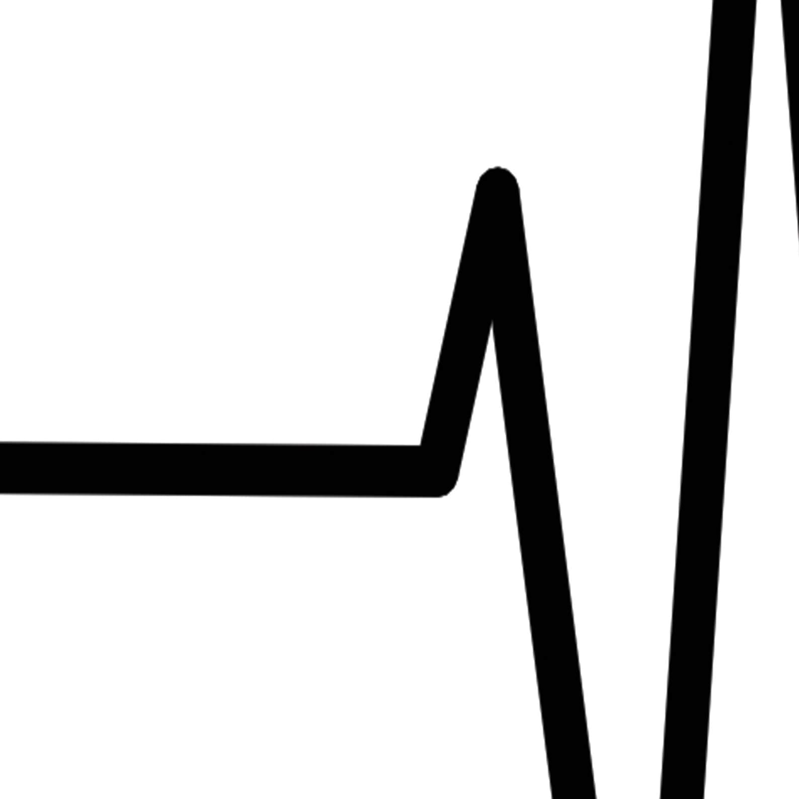 Heartbeat Print, Heartbeat Art, Heartbeat Wall Art, EKG Print ...