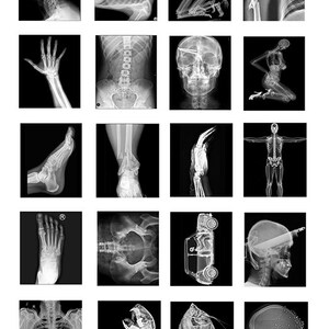 Miniature 1:25 G Scale Model Hospital Medical X-rays - Etsy