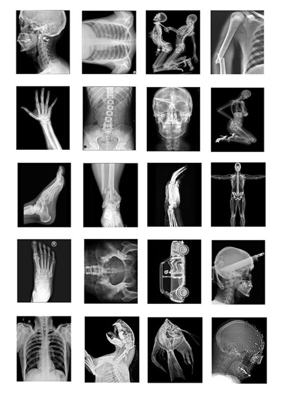 Miniature 1:25 G Scale Model Hospital Medical X-rays - Etsy
