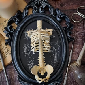 ANATOMY FRAME - Skull Medical Horror Home Decor Halloween Gothyc Decor ...