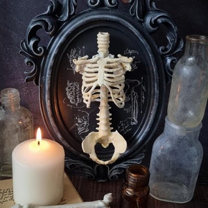 ANATOMY FRAME - Skull Medical Horror Home Decor Halloween Gothyc Decor ...