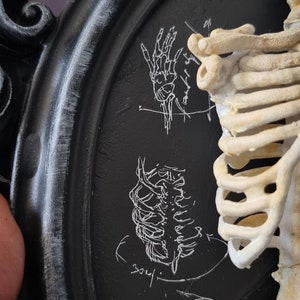 ANATOMY FRAME - Skull Medical Horror Home Decor Halloween Gothyc Decor ...