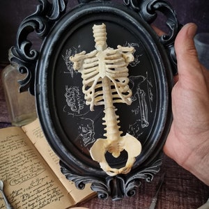 ANATOMY FRAME - Skull Medical Horror Home Decor Halloween Gothyc Decor ...