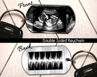 Ultrasound gifts | Etsy