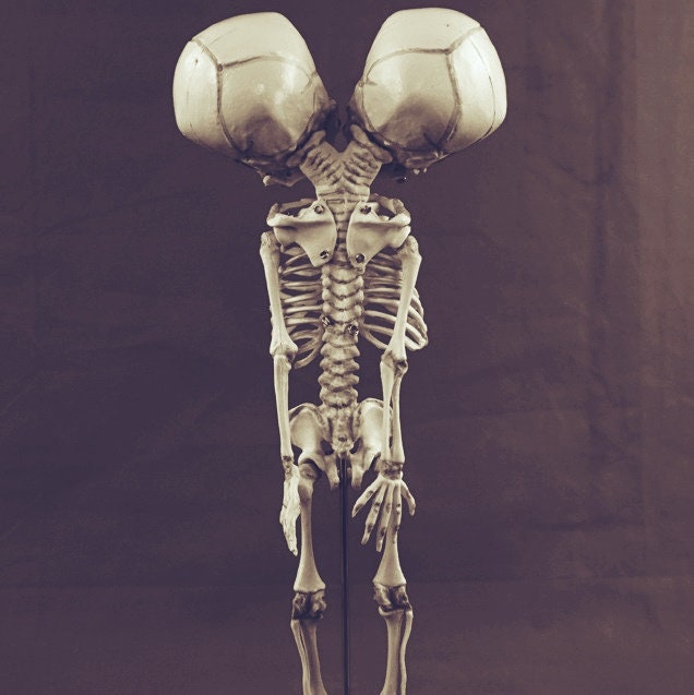 Double-headed Anatomy Skeletal Model Fetus, Skeleton, Skull, Bizarre ...